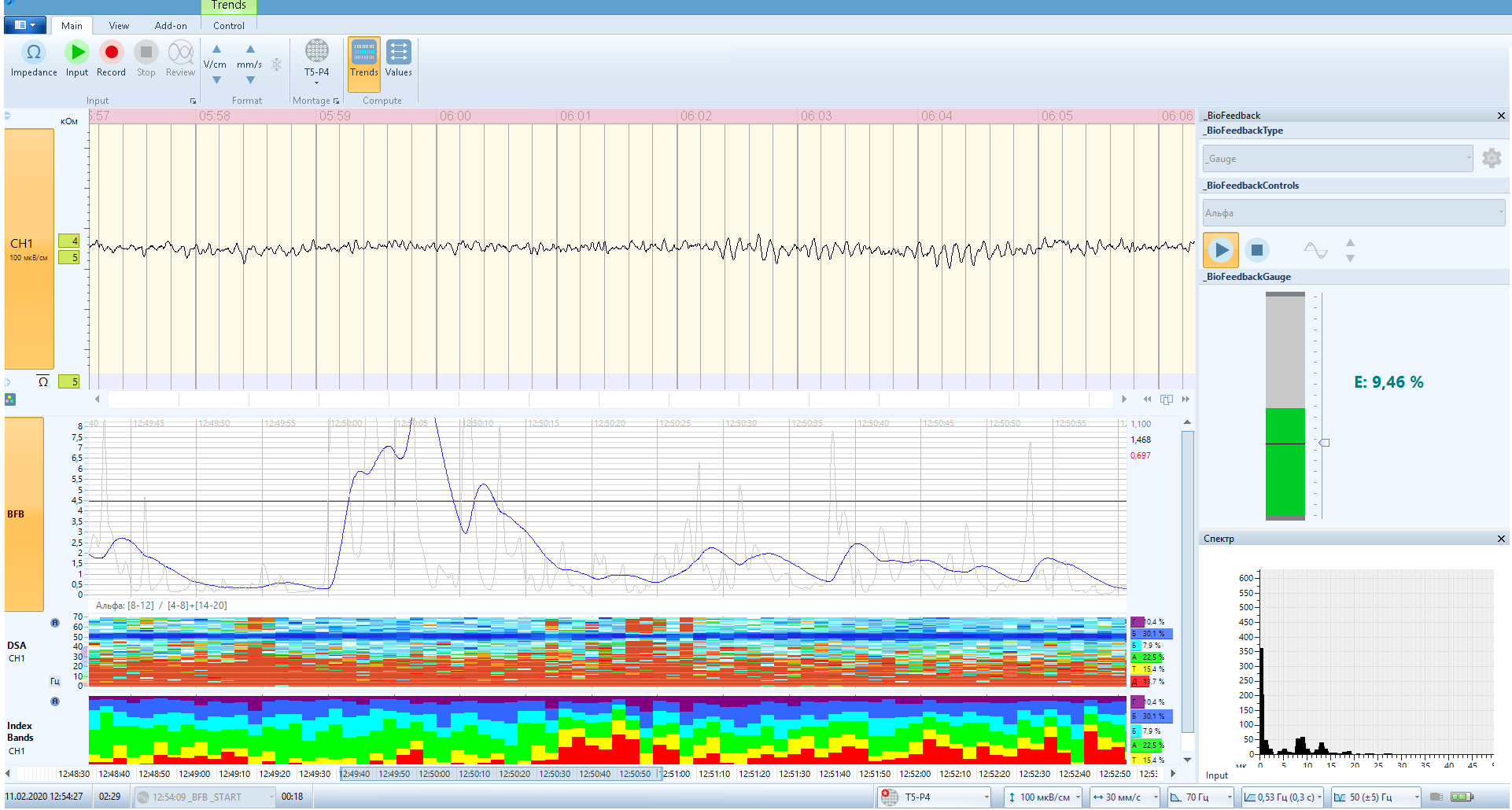EEGStudio Neurofeedback software – Mitsar :: Neurodiagnostics :: Electroencephalography (EEG)